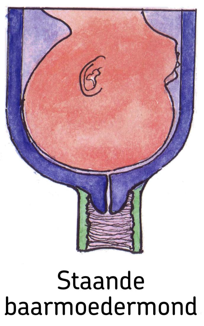 Inleiden van de bevalling | Jeroen Bosch Ziekenhuis